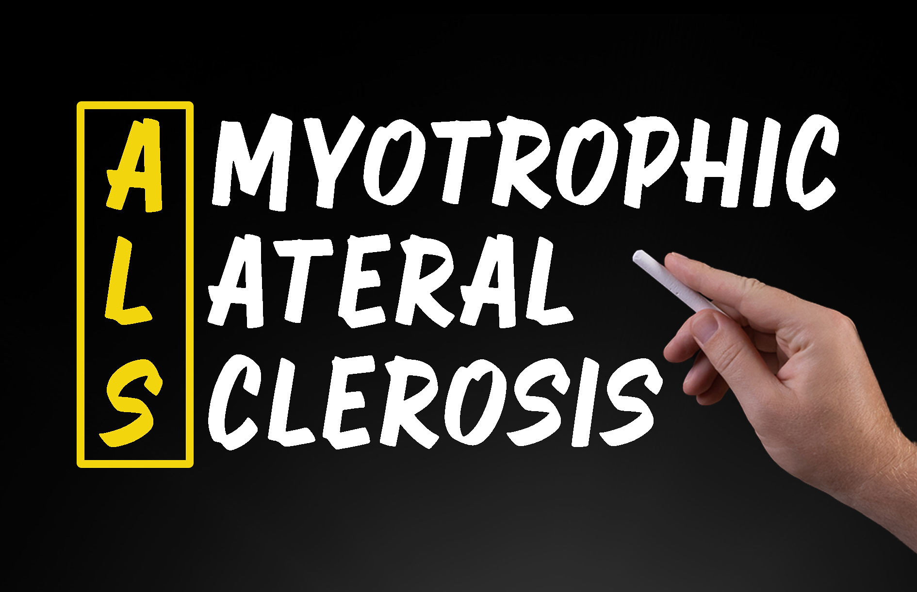 ALS Treatment with Stem Cells | Swiss Medica