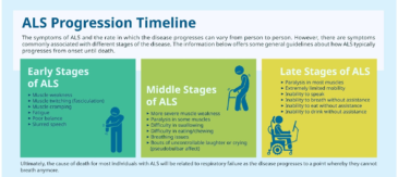 The Stages of ALS: Understanding the Progression of the Disease | Swiss ...