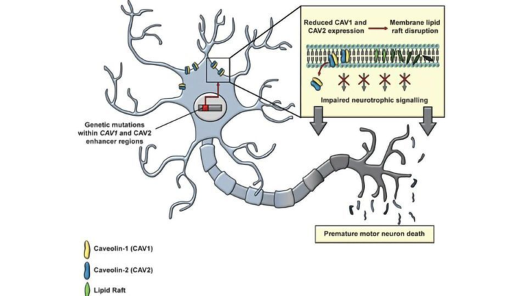 Motor Neuron Disease (MND) Treatment with Stem Cells | Swiss Medica