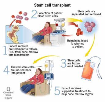 Stem Cell Treatment and Research in the Switzerland | Swiss Medica
