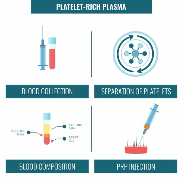 How Does PRP Therapy Work? | Swiss Medica