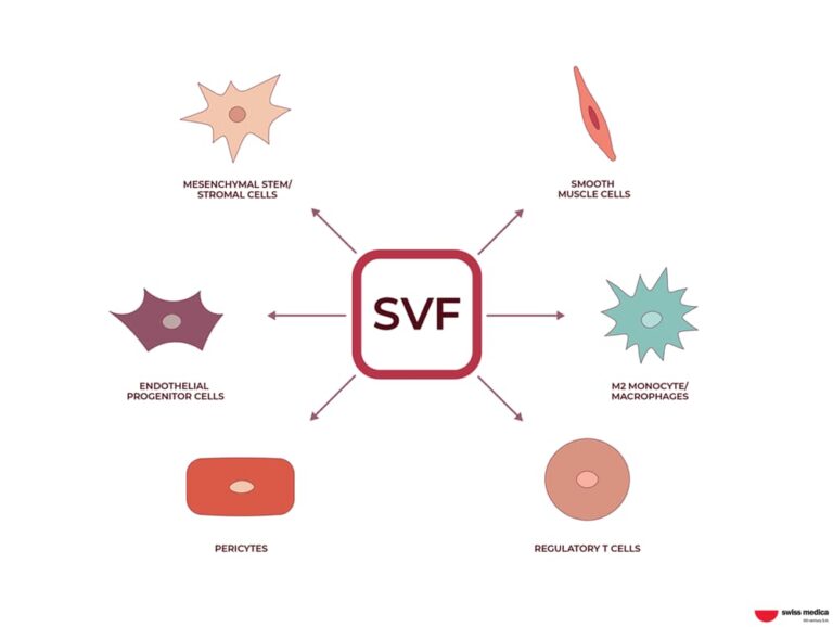 Stromal-Vascular Fraction Therapy: Benefits and How It Works | Swiss Medica
