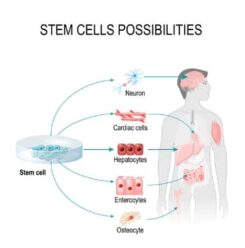 How Much Does a Stem Cell Transplant Cost in 2024? | Swiss Medica