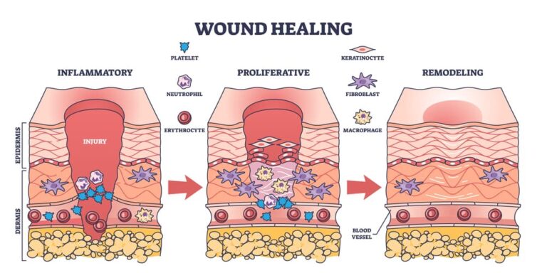 Stem Cells for Scar Treatment | Swiss Medica
